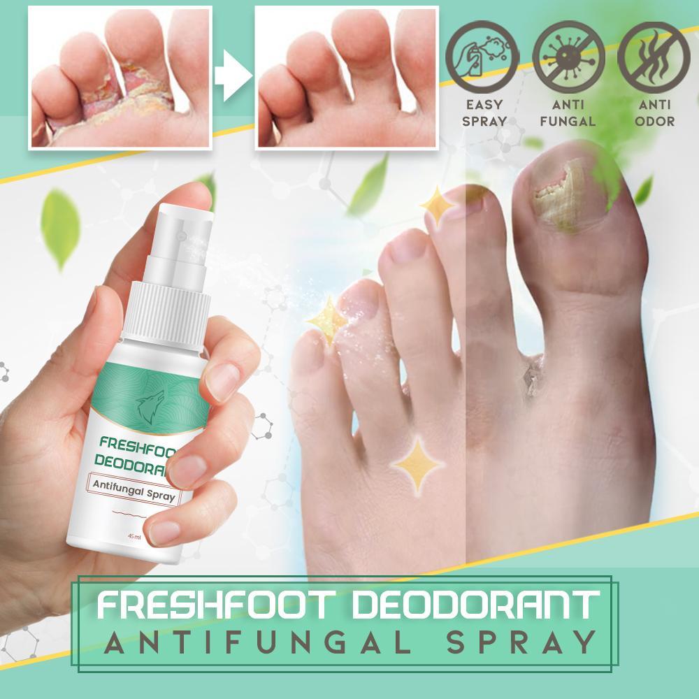 FreshFoot Deodorant Antifungal Spray – KITOYL
